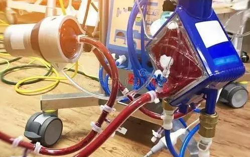 解密ICU的终极武器ECMO - 知乎