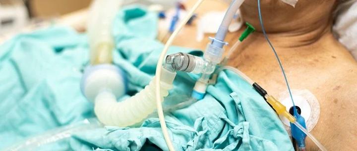 科研小工具分享｜Ricker 镇静-躁动评分（Sedation-agitation scale，SAS） - 知乎