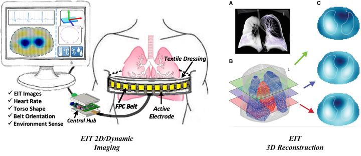电阻抗层析成像（Electrical Impedance Tomography，EIT） - 知乎