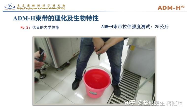 3D生物束带有效果没? - 知乎