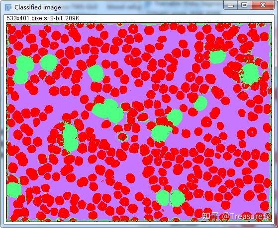 ImageJ实用技巧——基于机器学习的自动细胞分割(插件篇) - 知乎
