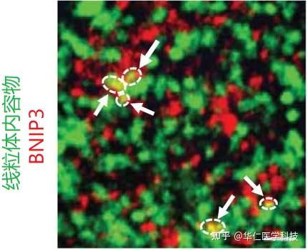 线粒体功能障碍是脑老化的基本特征之一，BNIP3蛋白可诱导线粒体自噬，保护脑部神经元健康 - 知乎