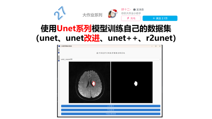 Unet系列模型在自己医学数据集上的使用（unet、unet++、r2net、attention unet以及unet的改进） - 知乎