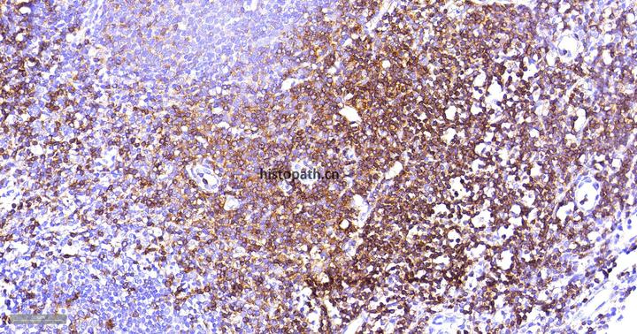 免疫组化（IHC）实验操作技术指南 - 知乎
