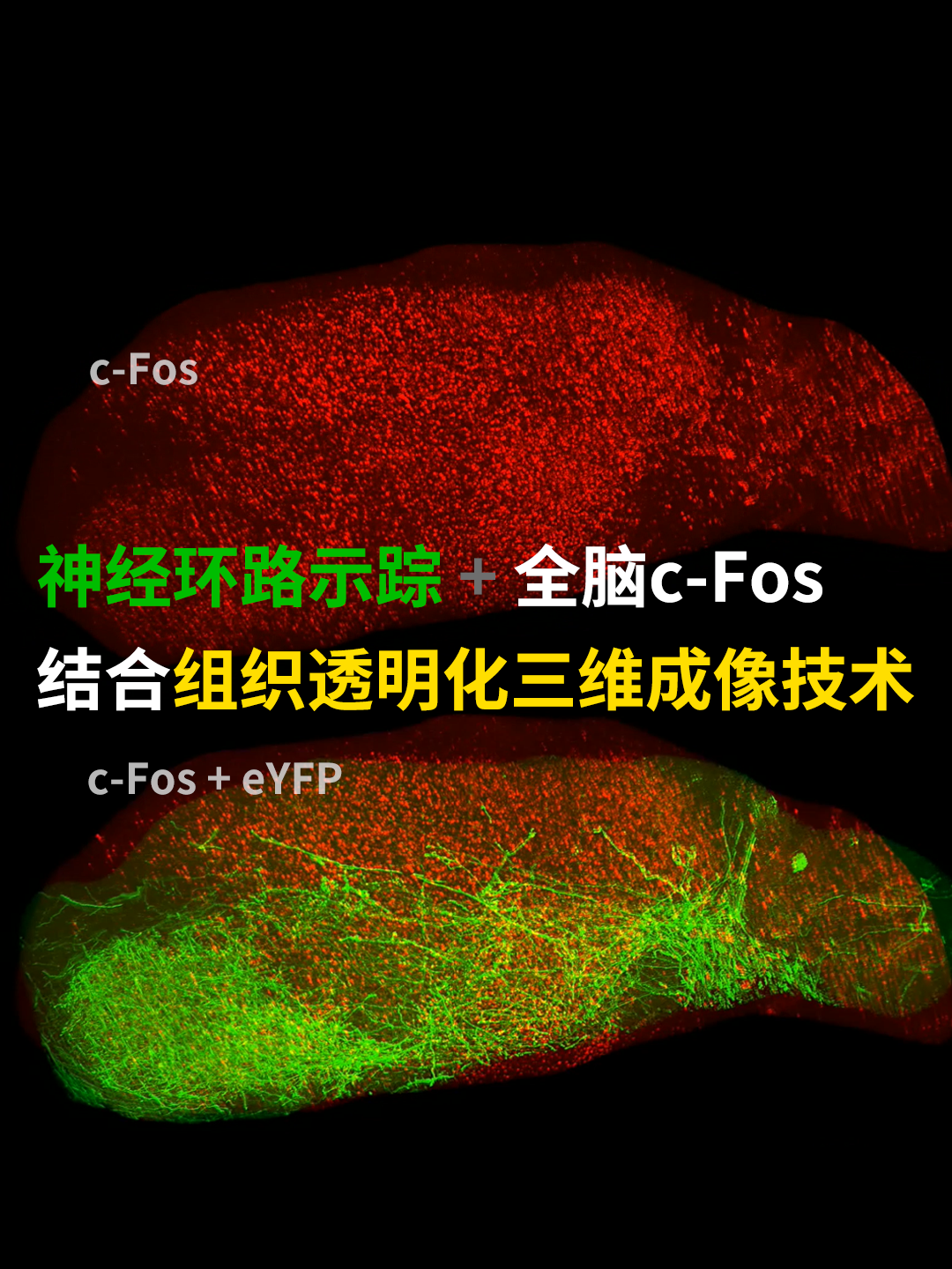 全脑c-Fos染色+神经环路示踪+组织透明化三维成像技术！ - 知乎