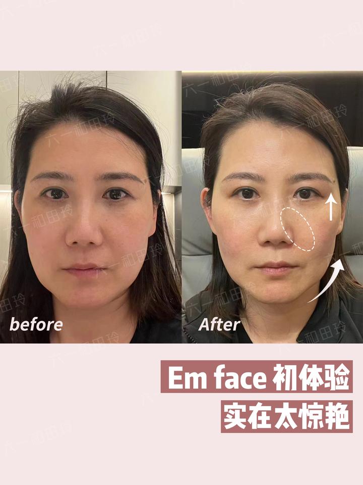 来repo一下我的EM Face初体验，真的好惊艳。 - 知乎