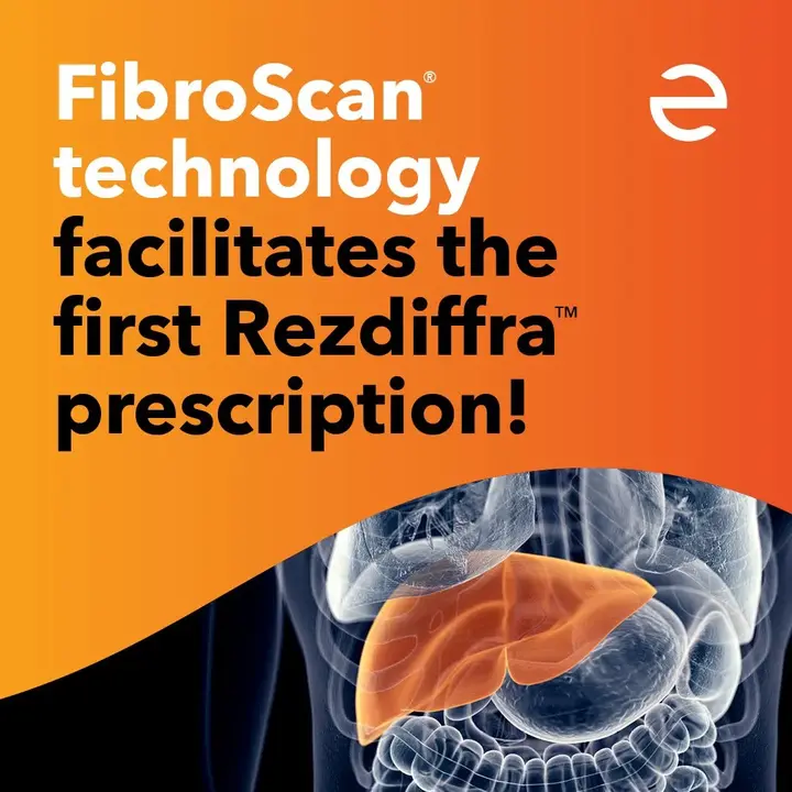 首位接受MASH新药Rezdiffra™治疗患者出现，通过FibroScan®识别确定！ - 知乎