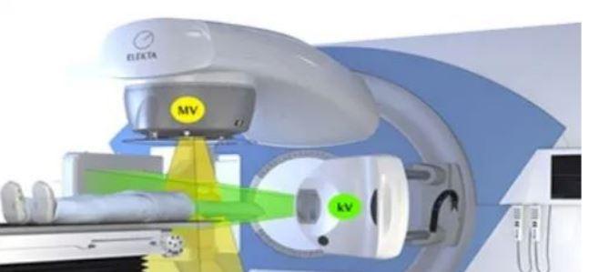 什么是CBCT？它和CT有什么区别？ - 知乎