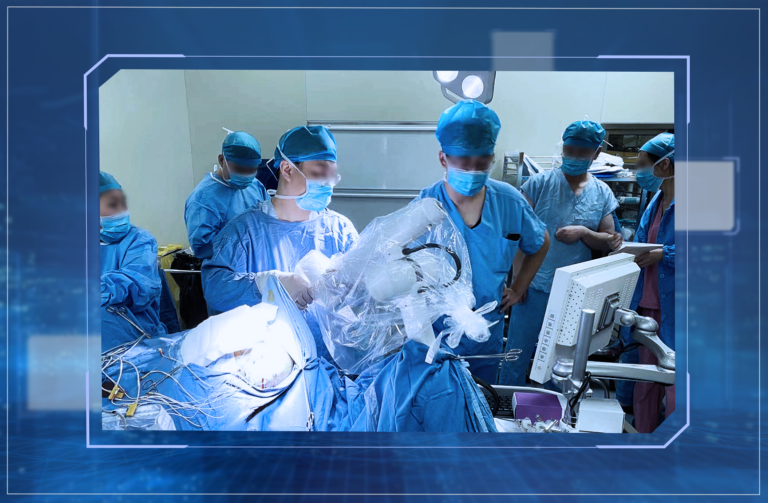 浙江省立同德医院完成首例医疗机器人辅助SEEG手术 - 知乎