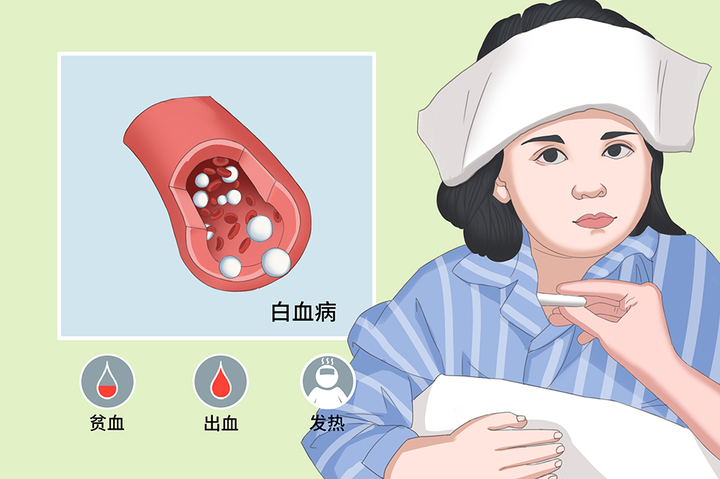 CAR-T细胞疗法Tecartus（brexu-cel）治疗复发/难治性B细胞急性淋巴细胞白血病，提高无进展生存期！ - 知乎