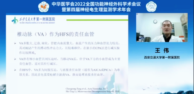 中华医学会2022全国功能神经外科学术会议：《面肌痉挛微血管减压术中椎动脉压迫的减压策略与临床分析》 - 知乎