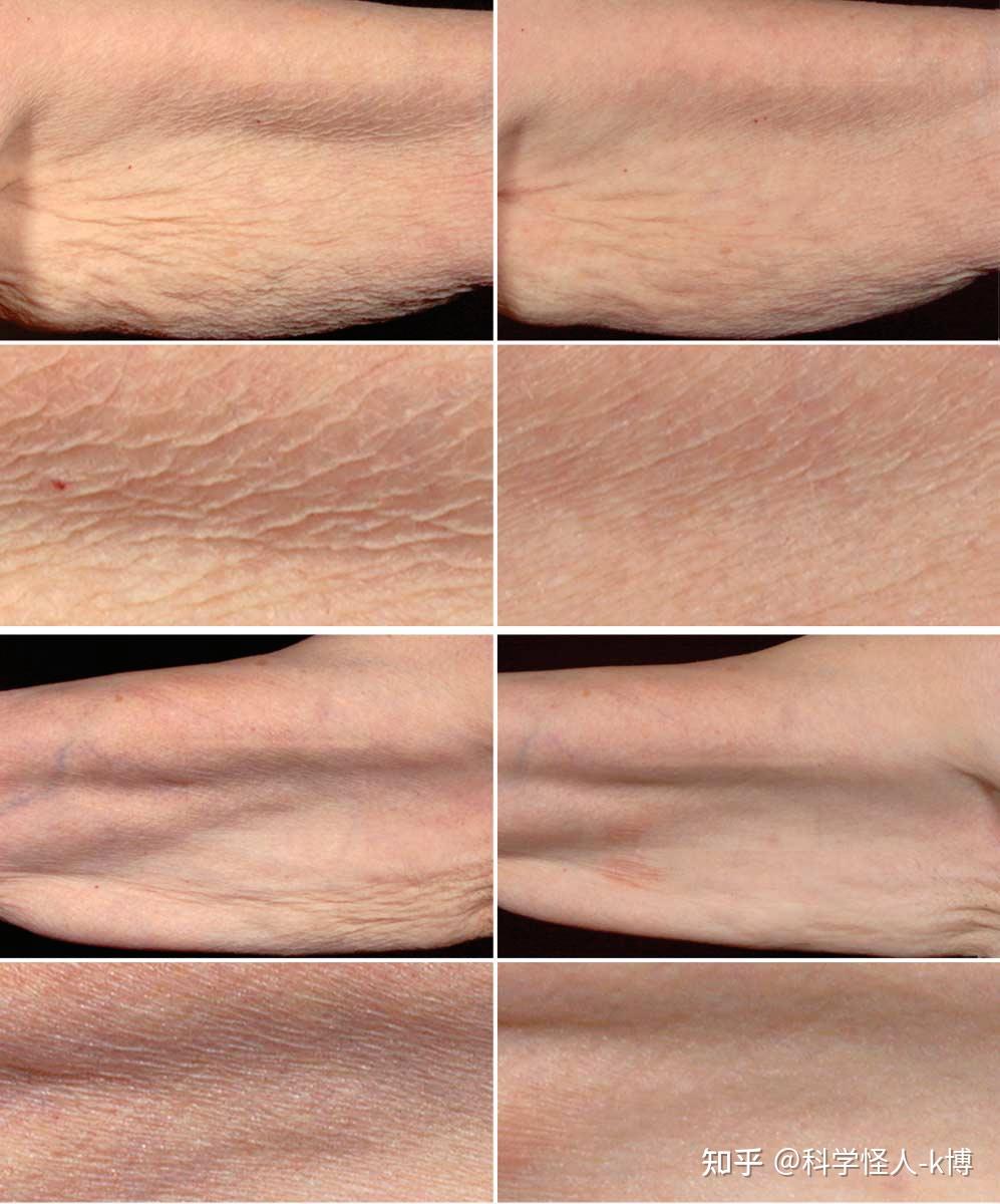 A醇有哪些推荐？ - 知乎