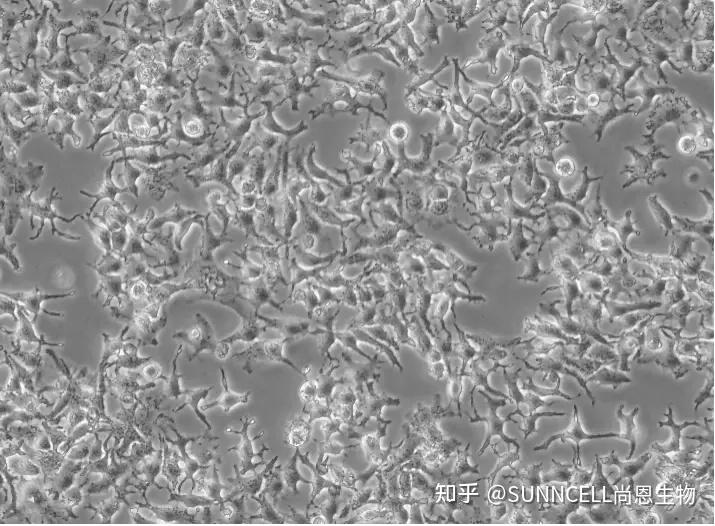 HuH-7(人肝癌细胞)培养注意事项 - 知乎