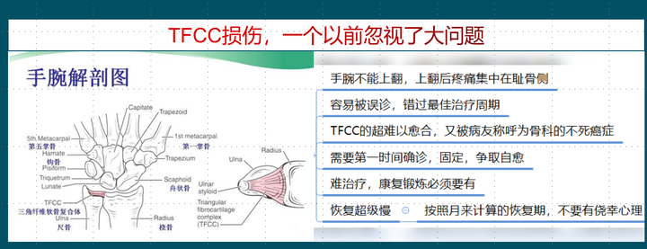 关于TFCC损伤，我们不应该忽视的大问题 - 知乎