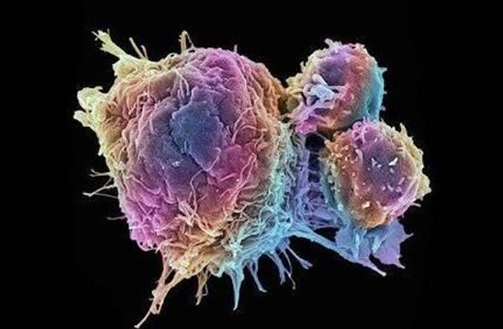 Nat Rev Cancer | 癌症耐药的非遗传机制 - 知乎