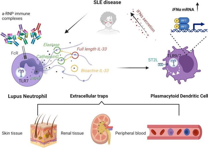 【文献分享】NETs联合IL-33在SLE中的作用 - 知乎