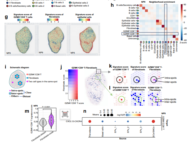 文献解读 | 10x 单细胞HD空转联合应用—揭示GZMK+CD8+ T细胞在鼻息肉中的促炎作用 - 知乎