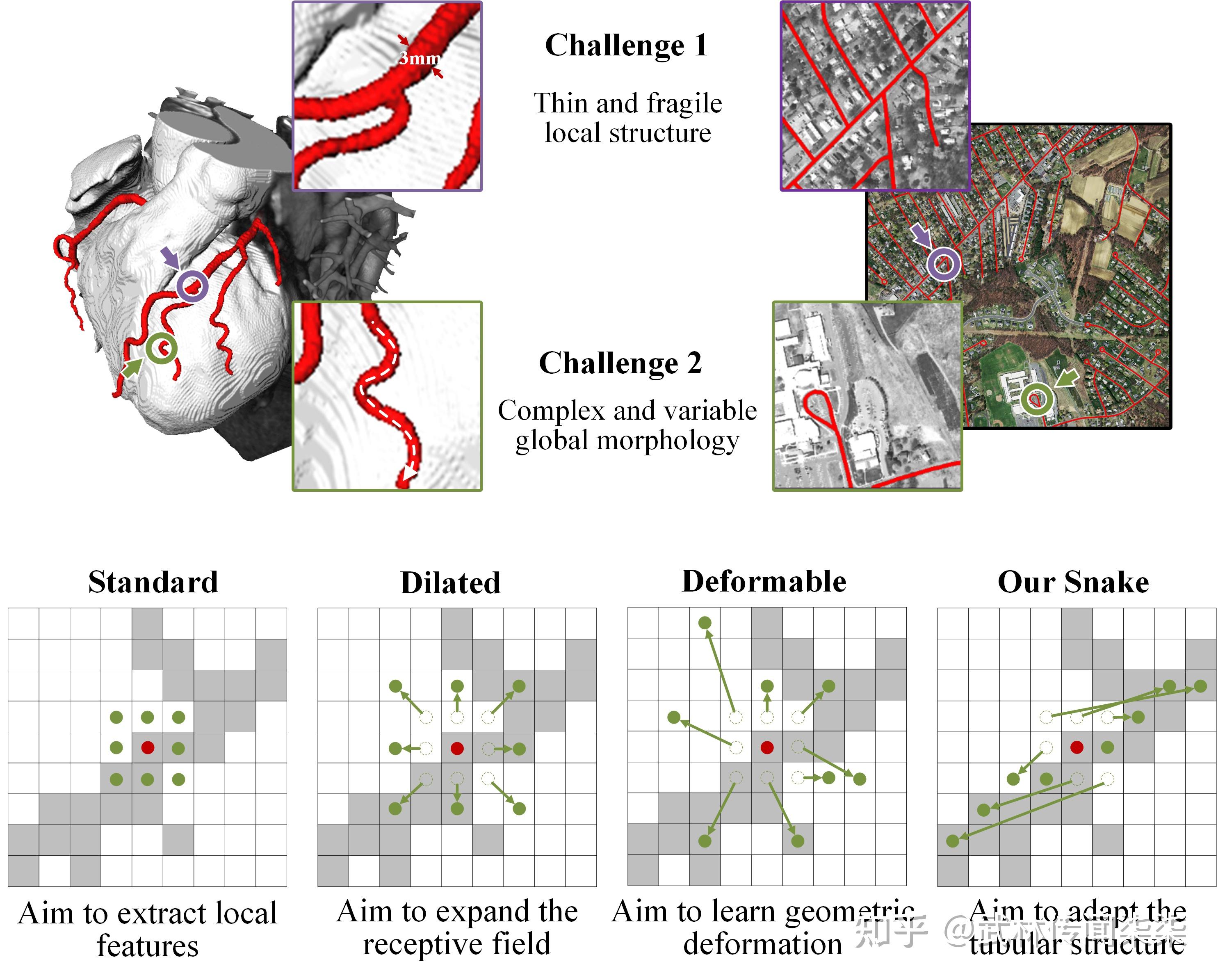 ICCV2023｜动态蛇形卷积（Dynamic Snake Convolution）用于管状结构分割 - 知乎