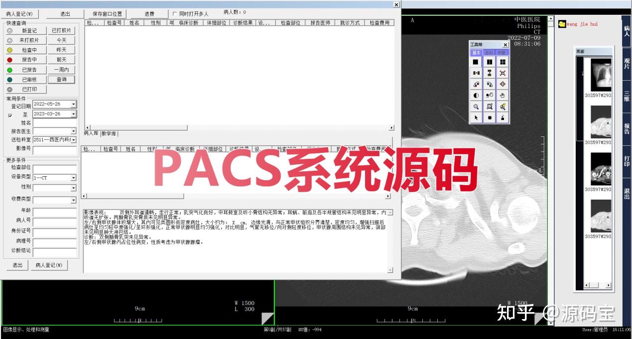 医院的HIS、CIS、LIS、EMR、PACS、RIS、CAD都是指哪些系统，谢谢，请分别回答?? - 知乎