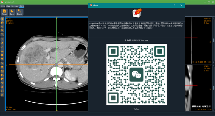 Dicom 图像显示 知乎 