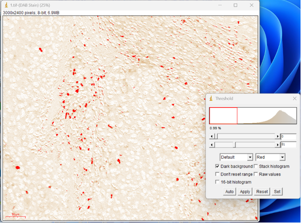 解忧小工具｜保姆式教程！用Image J进行免疫组化分析（IHC score评分） - 知乎