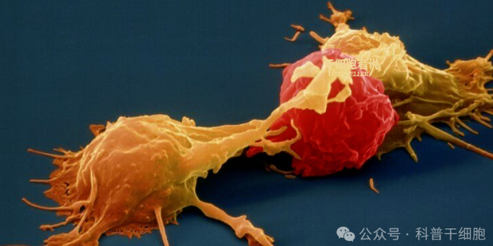 抗癌免疫细胞疗法：DC、CIK、NK、TIL、γδT... 有何不同？ - 知乎