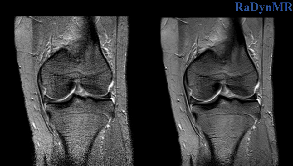 临床案例——RaDynMR、RaDynPET、RaDynCT、RaDynSPECT - 知乎