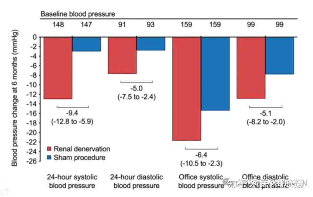 国产第3家，百心安RDN系统获批！ - 知乎