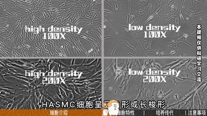 HASMC细胞培养，人主动脉平滑肌细胞培养攻略-丰晖生物 - 知乎