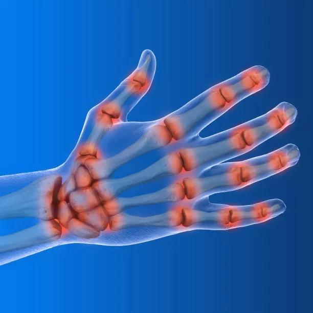 SCI期刊推荐:RHEUMATOLOGY - 知乎