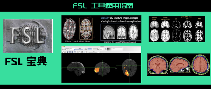 介绍一款 MRI&CT 图像预处理强大工具--FSL - 知乎