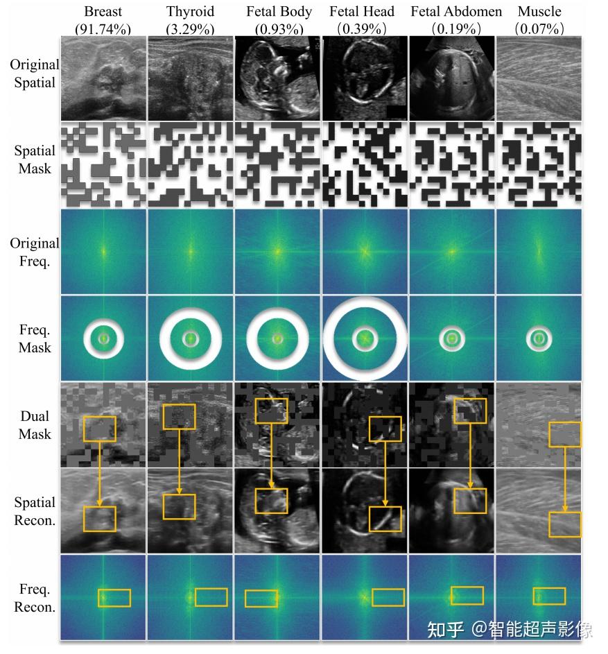 USFM：适用于各种任务和器官的通用超声基础模型，实现标签高效图像分析 - 知乎