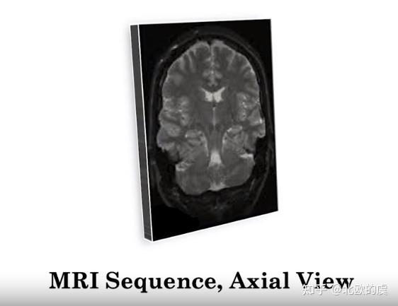 医学影像深度学习系列（六）- 了解MRI（上）-多通道3D图像 - 知乎