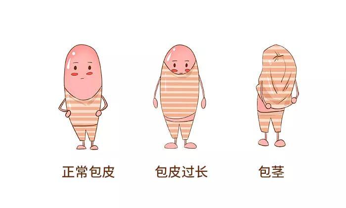 80的美国男性割包皮 你们家男宝宝割了吗？ 知乎