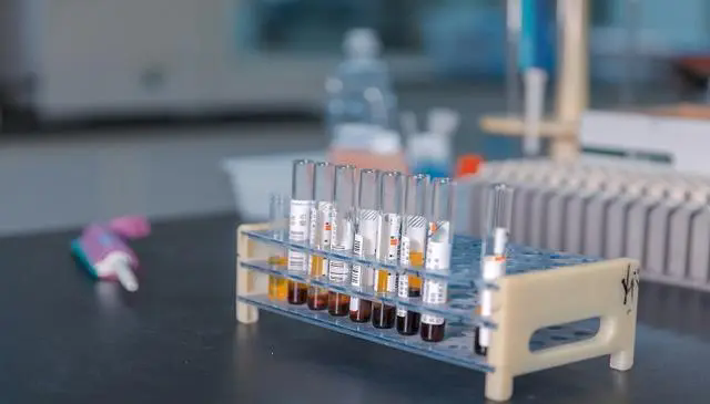 胆固醇氧化酶 Cholesterol Oxidase(CHO)｜CAS:9028-76-6 - 知乎