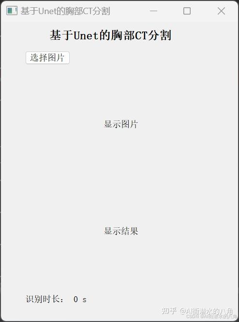 医学图像算法之基于Unet的胸部CT分割 - 知乎
