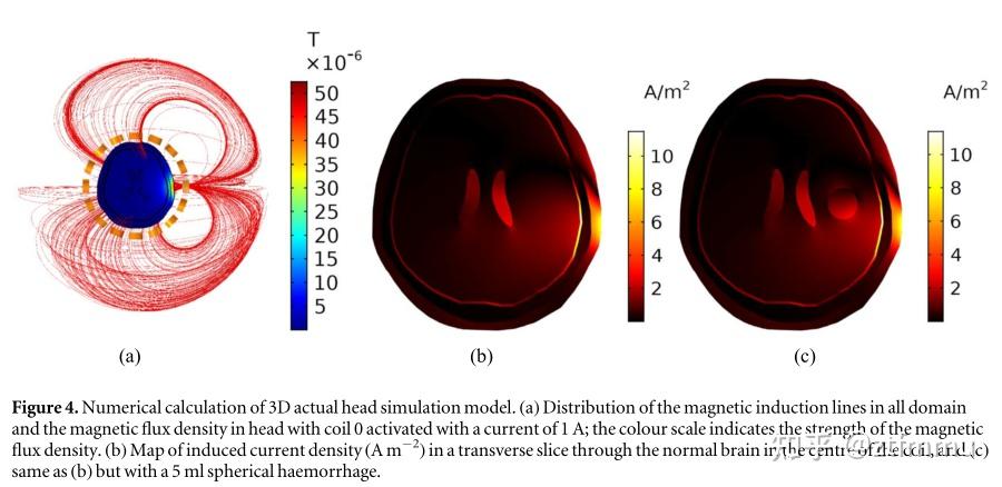 对于电阻抗成像技术（EIT）在世界上研究进展如何？ - 知乎