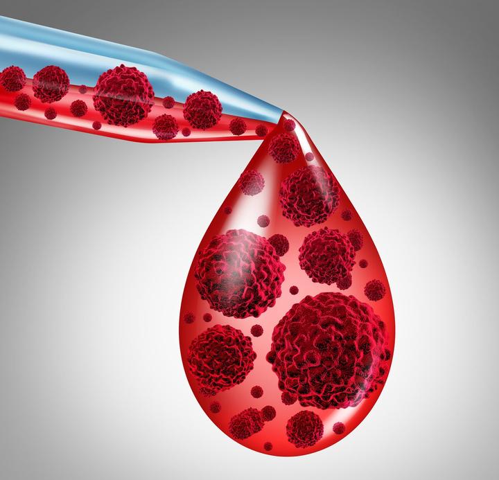 Talvey在复发/难治性多发性骨髓瘤患者中的安全性与疗效 - 知乎