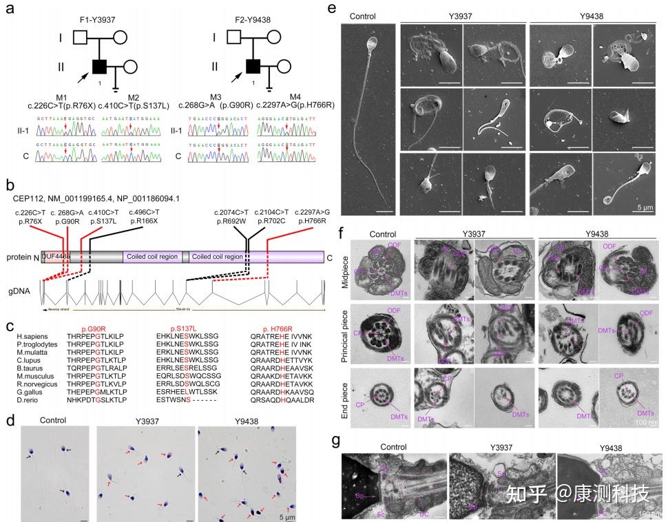 NC|男性不育新机制：CEP112突变损害相分离和必需生育mRNA的翻译 - 知乎