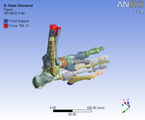 分享给大家看看，我做的（踝关节）有限分析案例 - 知乎