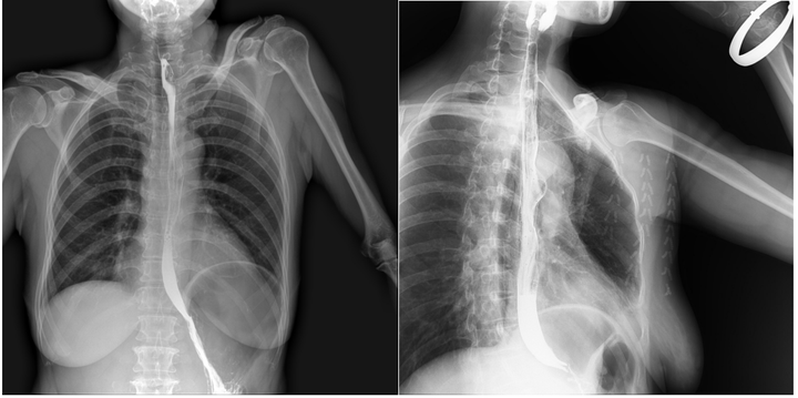 动态DRF在老年病医院的优势 - 知乎