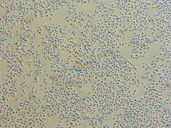 绝不能错过：B16-F10小鼠黑色素瘤高转细胞培养完美攻略 - 知乎