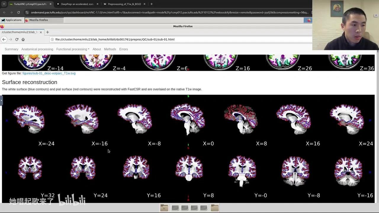DeepPrep-基于深度学习的fMRI预处理工具 - 知乎