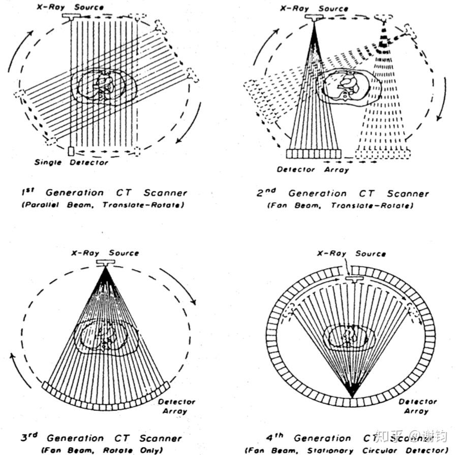 现代医学成像（3）——CT（基本原理与图像重建） - 知乎