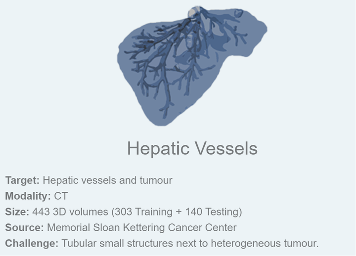 MSD Hepatic Vessel 数据集介绍 - 知乎