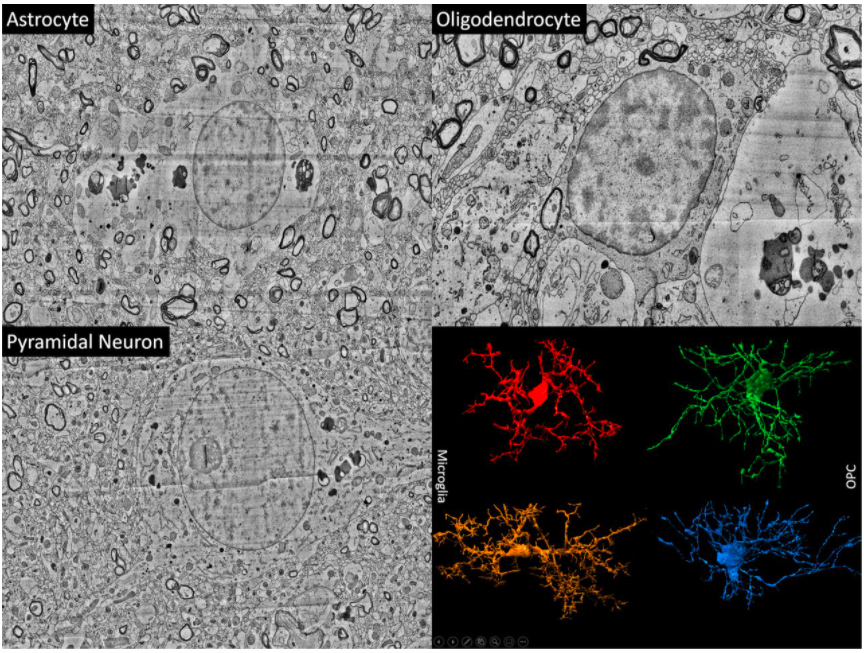 谷歌发布史上最强人类大脑「地图」，在线可视3D神经元「森林」！ - 知乎