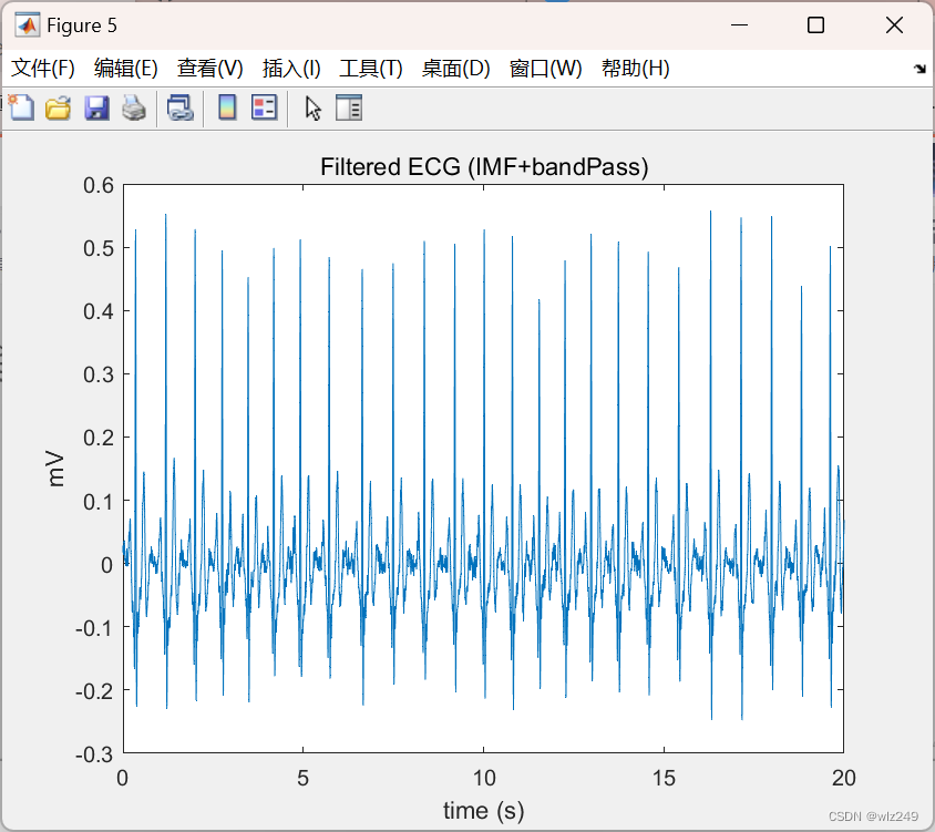 通过EEMD进行心脏频率和心电图信号去噪（Matlab代码实现） - 知乎