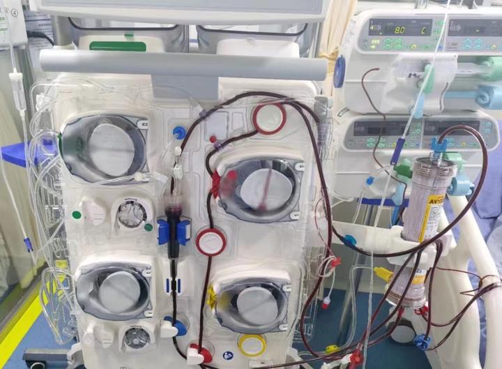 连续性血液净化过程中的细节管理 - 知乎