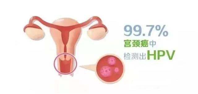 感染高危型HPV可以恢复吗？ - 知乎