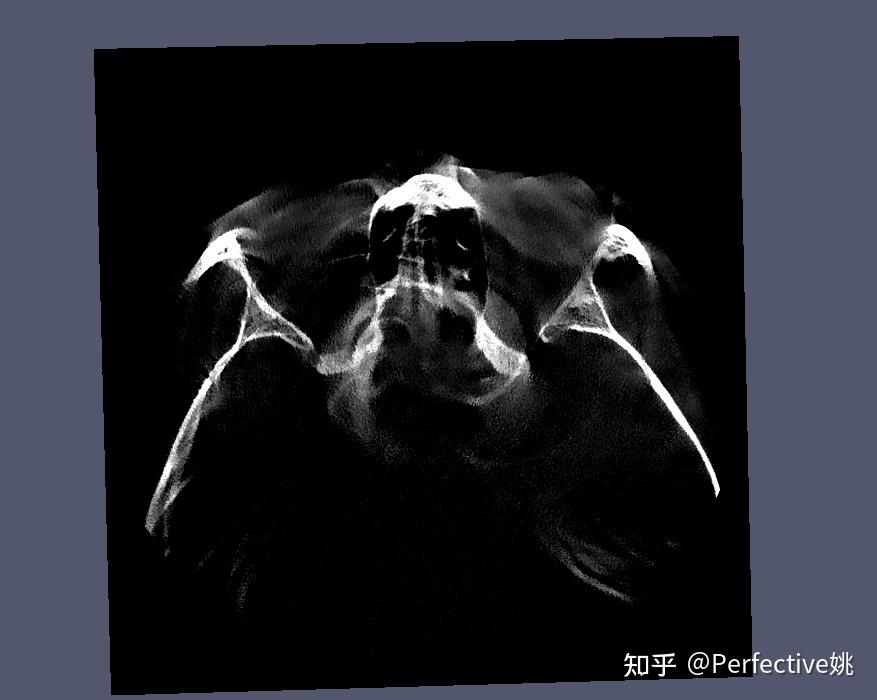 vtk.js之RenderWindow渲染图像展示 - 知乎